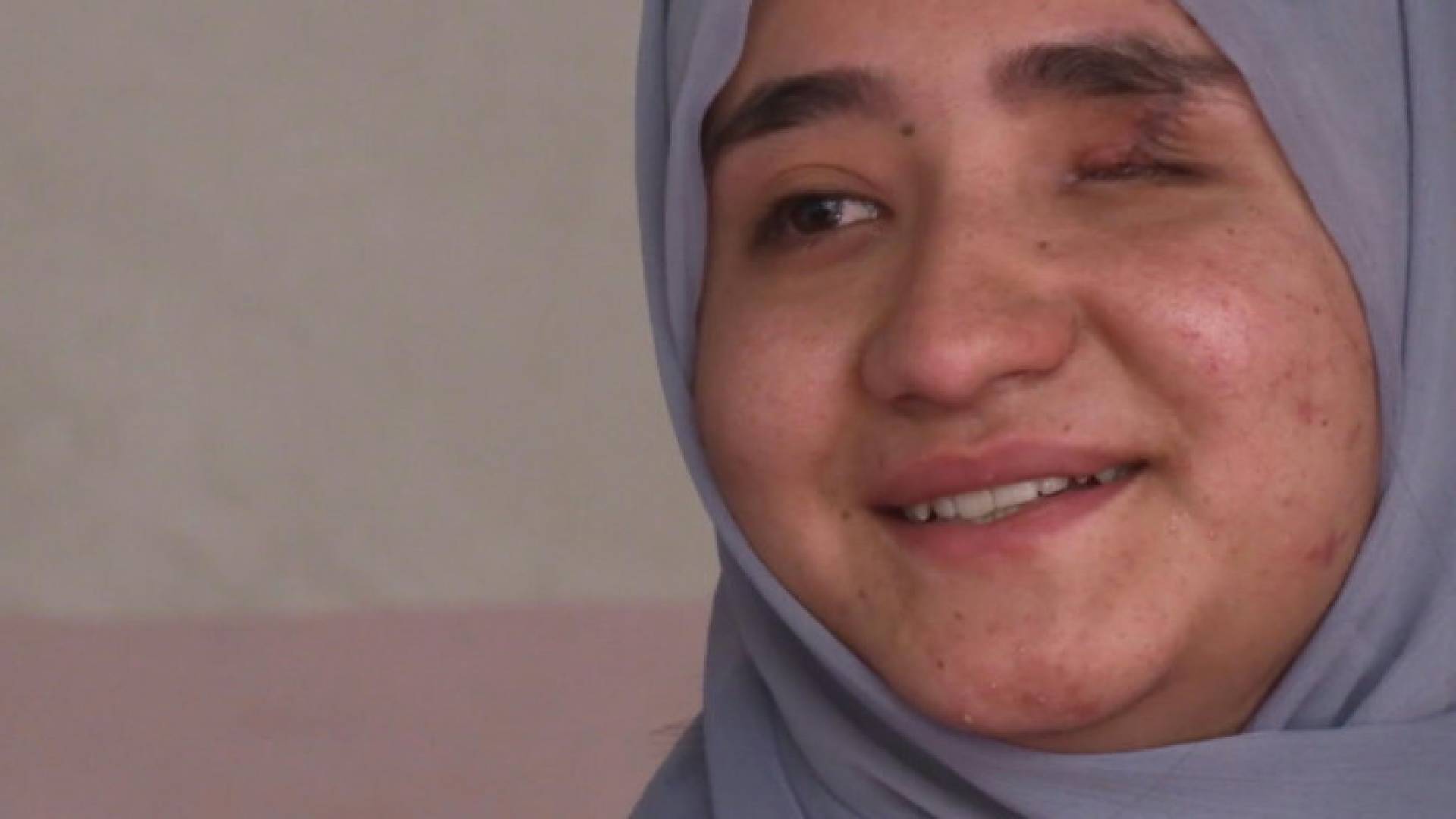 Roya News | Hazara girl wounded in deadly Afghan attack triumphs in exams
